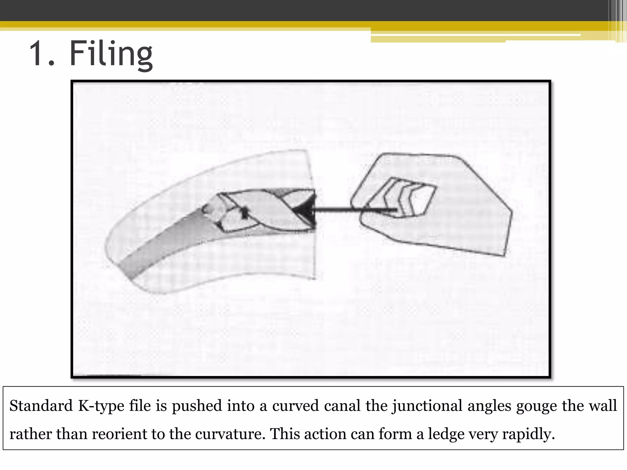 Cleaning and Shaping of Root Canal Systems | PPTX