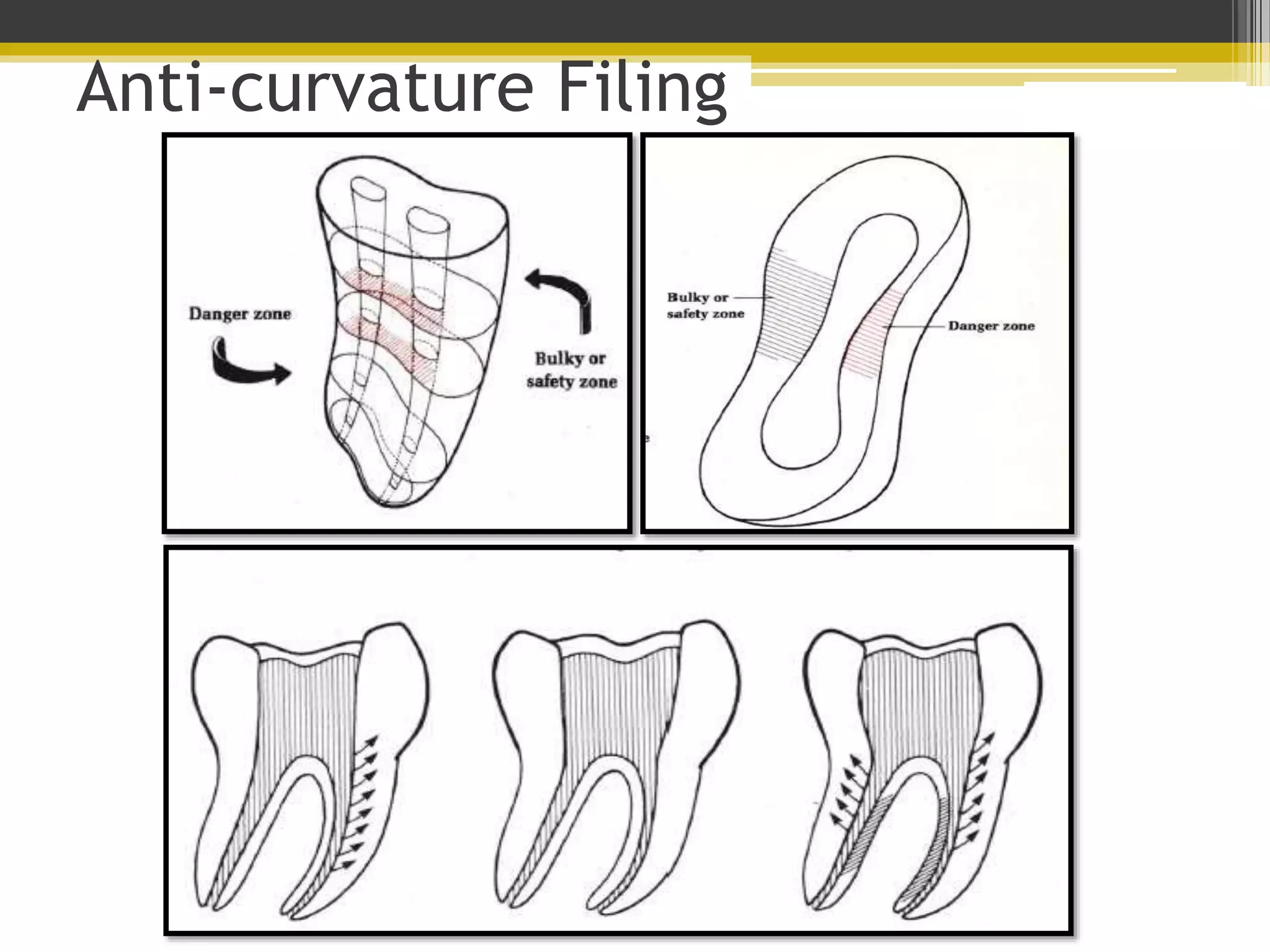 Cleaning and Shaping of Root Canal Systems | PPTX