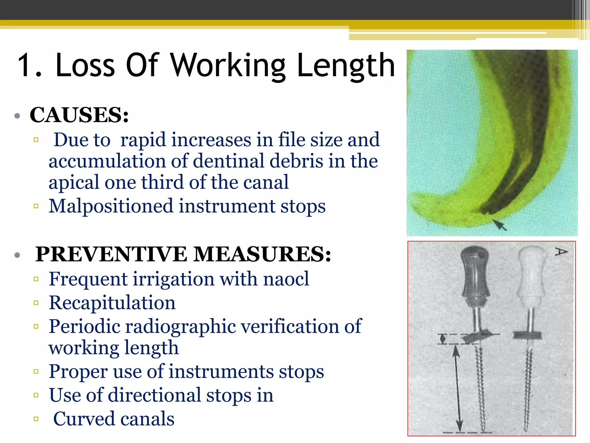 Cleaning and Shaping of Root Canal Systems | PPTX