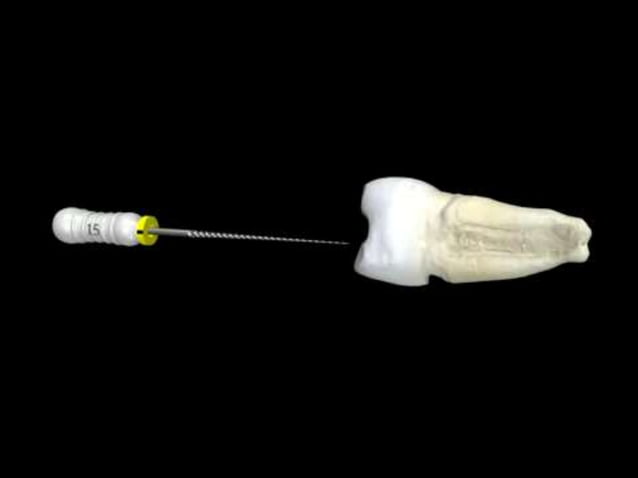 Cleaning and Shaping of Root Canal Systems | PPTX
