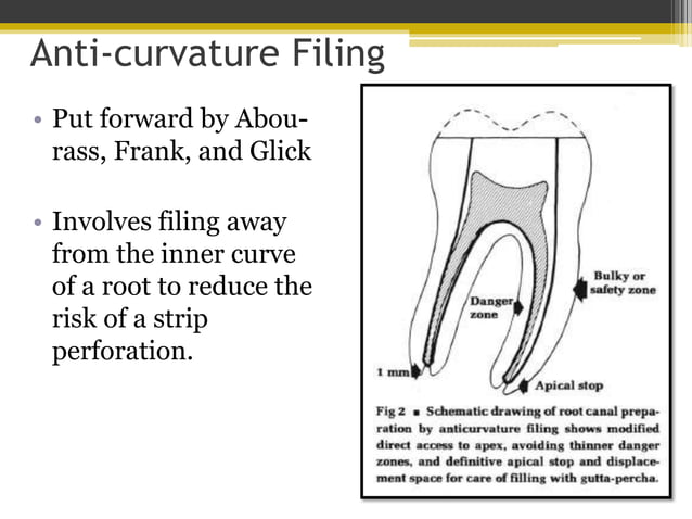 Cleaning and Shaping of Root Canal Systems | PPTX