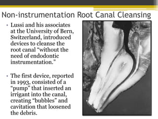 Cleaning and Shaping of Root Canal Systems | PPTX