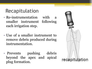 Cleaning and Shaping of Root Canal Systems | PPT