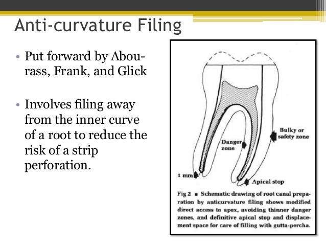 Cleaning and Shaping of Root Canal Systems