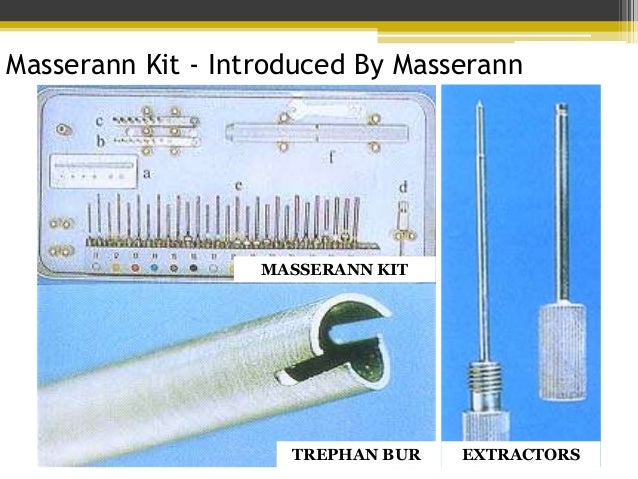 Cleaning and Shaping of Root Canal Systems