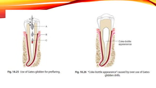 Cleaning and Shaping of the Root Canal System.pptx