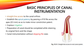 Cleaning and Shaping of the Root Canal System.pptx | Dental Health ...
