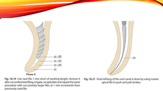 Cleaning and Shaping of the Root Canal System.pptx