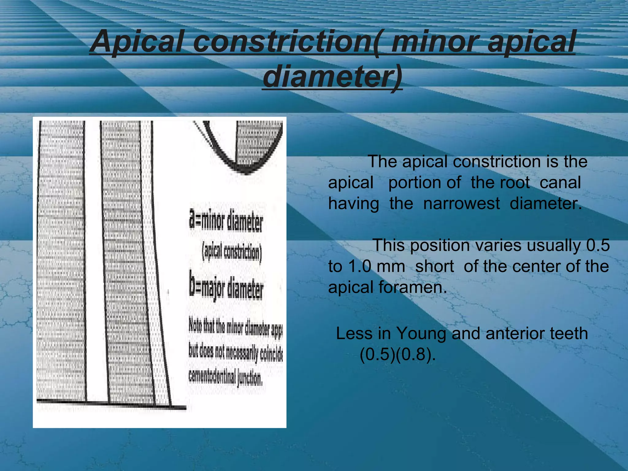 Cleaning and shaping the root canal system | PPT
