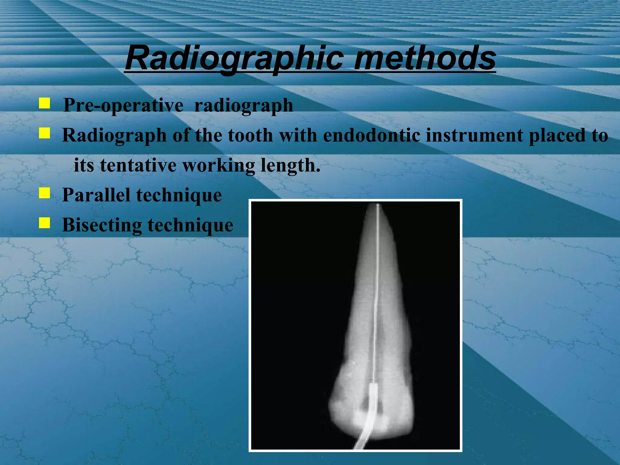Cleaning and shaping the root canal system | PPT