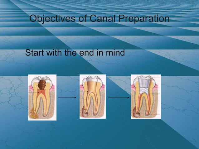 Cleaning and shaping the root canal system Cleaning and shaping the root canal system