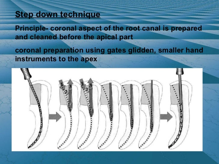 Cleaning and shaping the root canal system Cleaning and shaping the root canal system