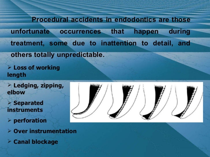 Cleaning and shaping the root canal system Cleaning and shaping the root canal system