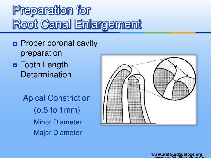 Apical Stop Vs Apical Seat at Abby Thorn blog
