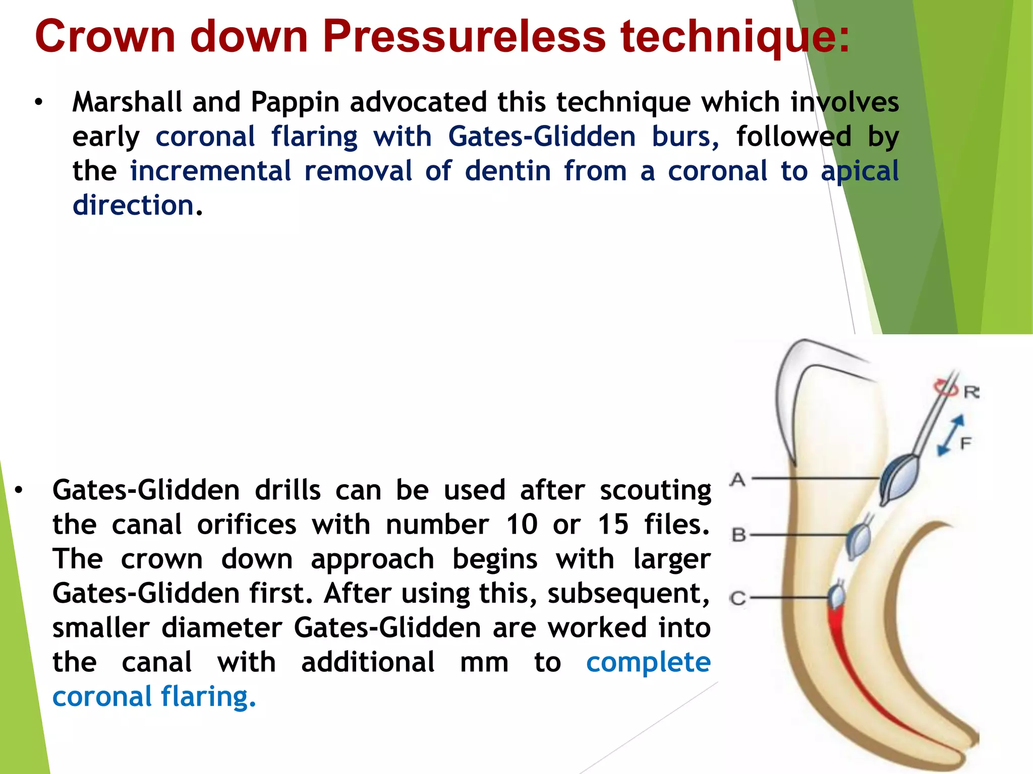 Cleaning & shaping of root canal sytem | PDF