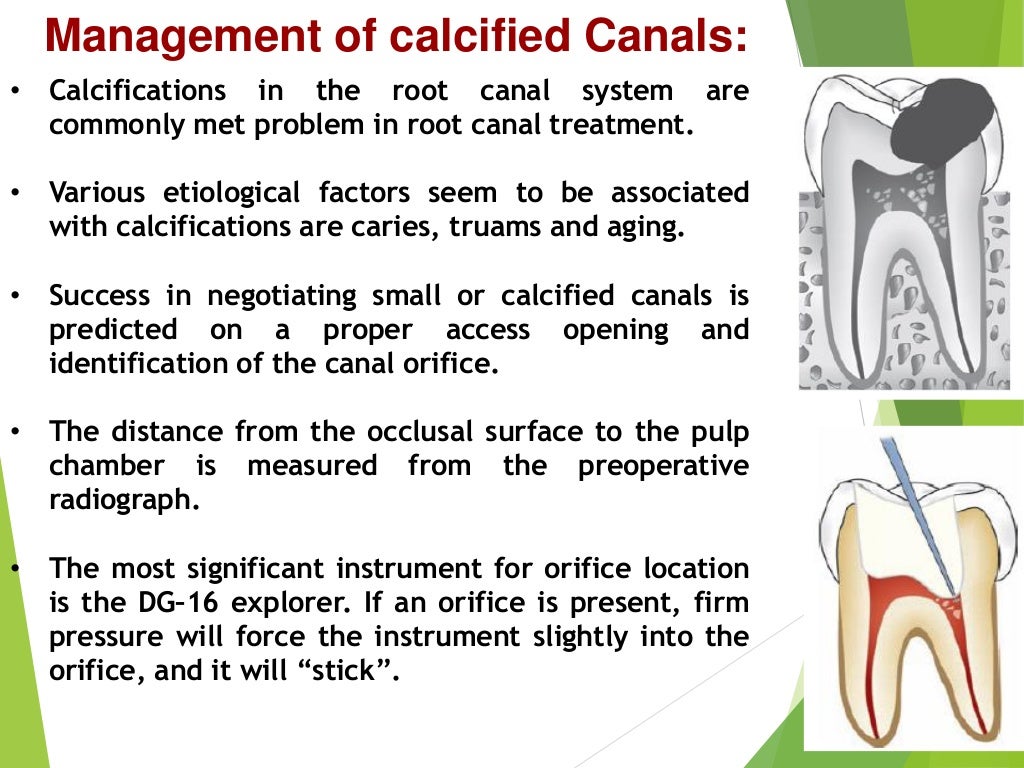 Cleaning & shaping of root canal sytem Cleaning & shaping of root canal sytem