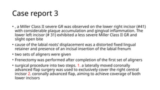 Clear Aligners - An efficient tool in the.pptx