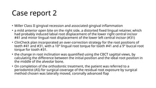Clear Aligners - An efficient tool in the.pptx