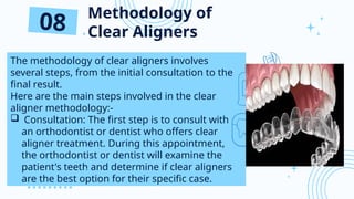 Clear Aligners, Orthodontics, SDC, by Dr. Tannu Singh | PPT