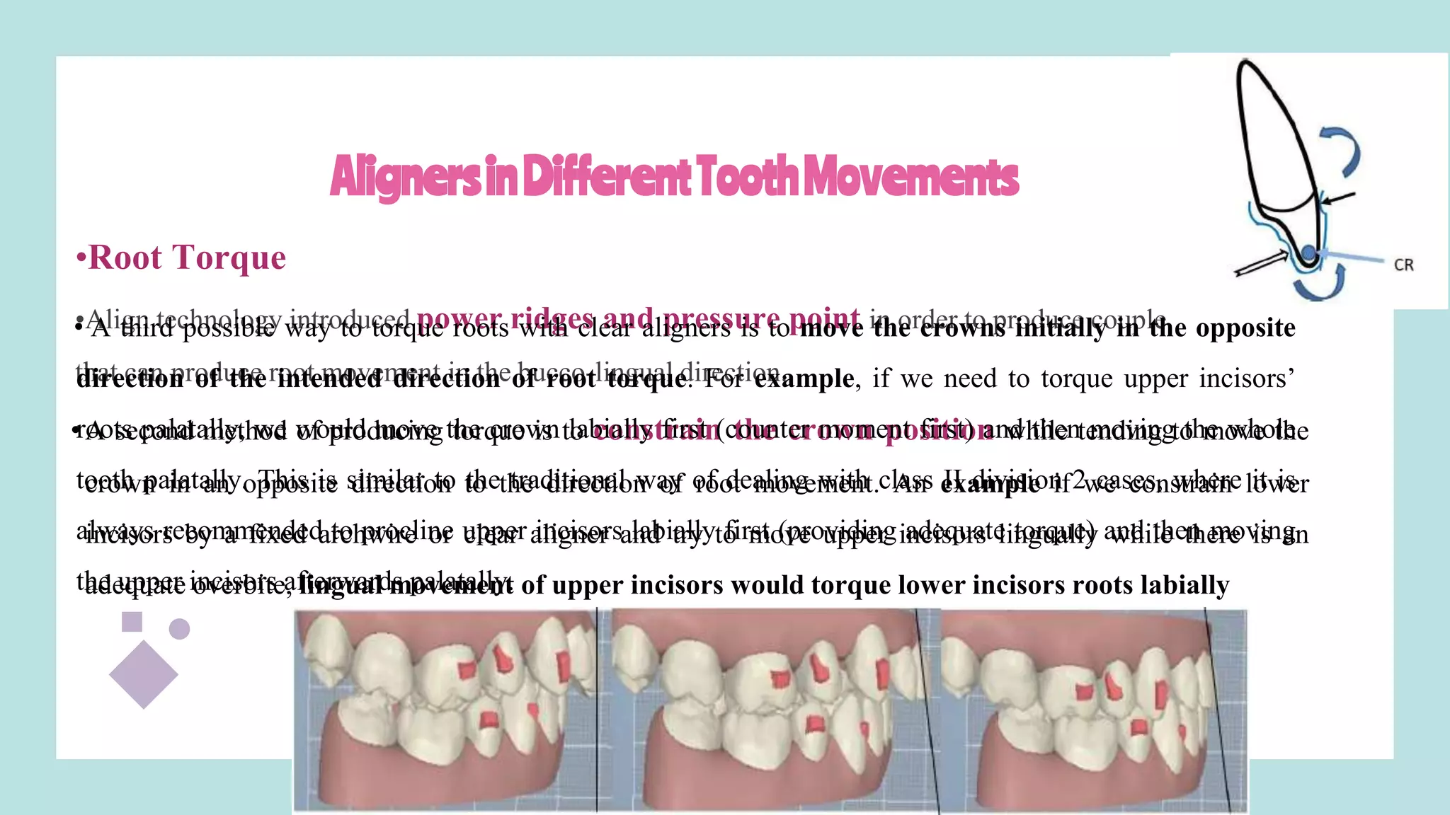 Clear Aligners in Orthodontics.pptx