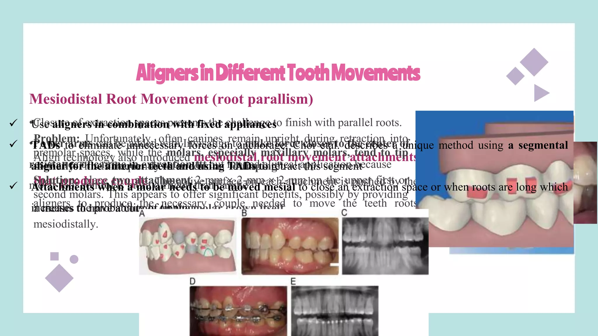 Clear Aligners in Orthodontics.pptx
