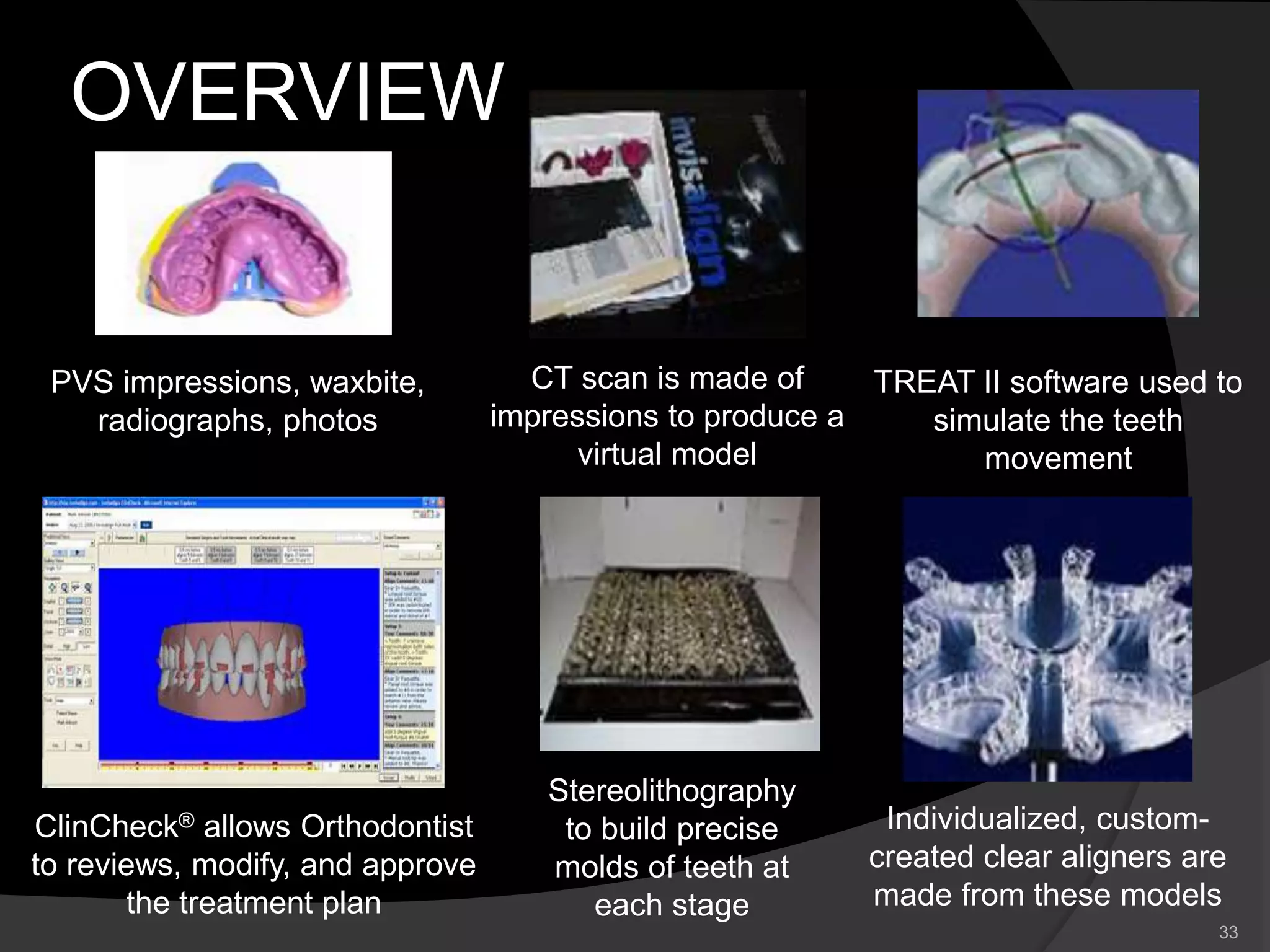 Clear aligner therapy | PPTX | Dental Health | Diseases and Conditions