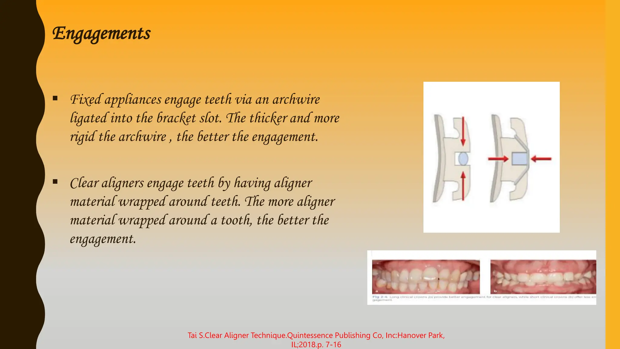 CLEAR ALIGNER THERAPY IN ORTHODONTICS .pptx