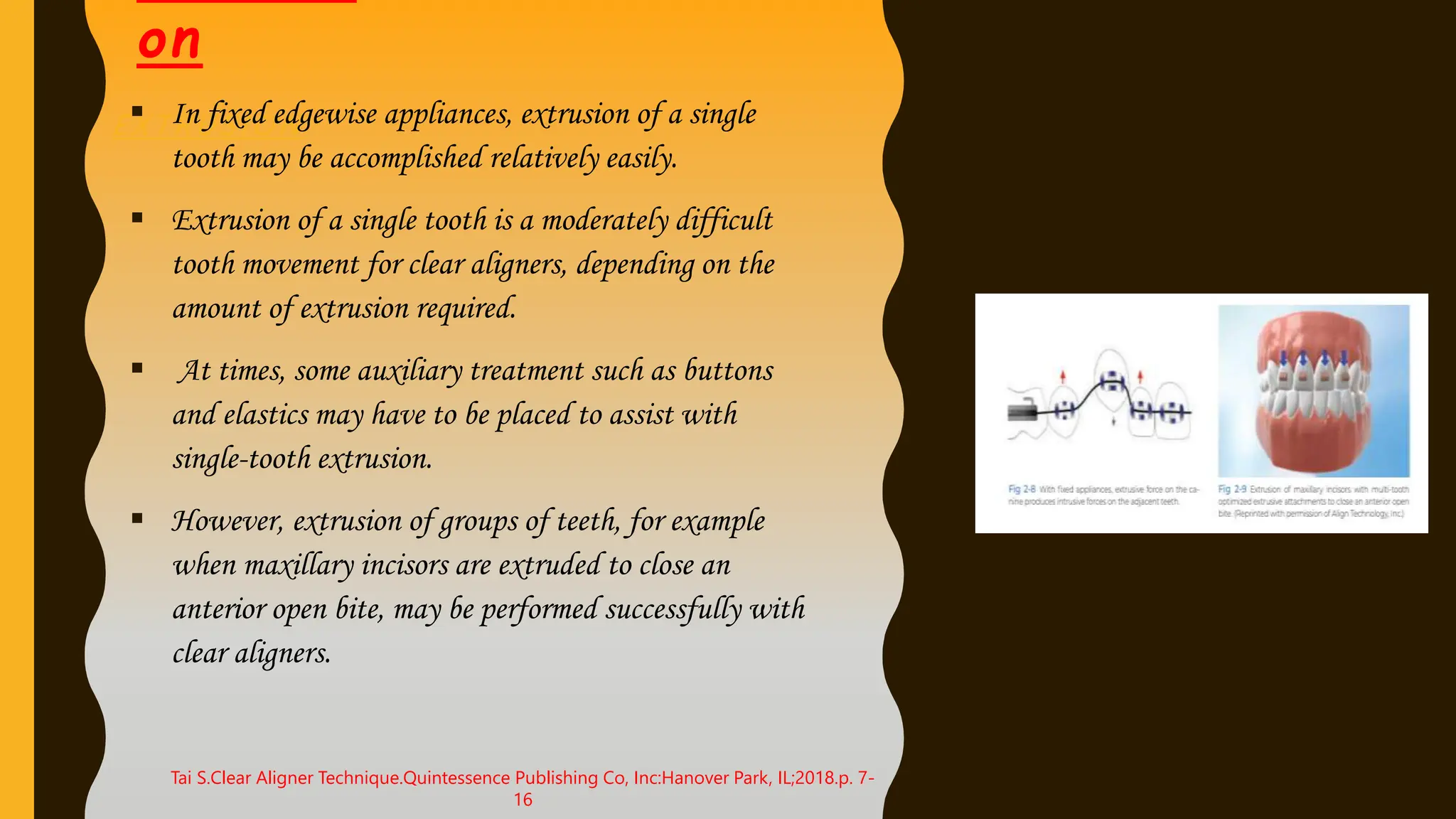CLEAR ALIGNER THERAPY IN ORTHODONTICS .pptx