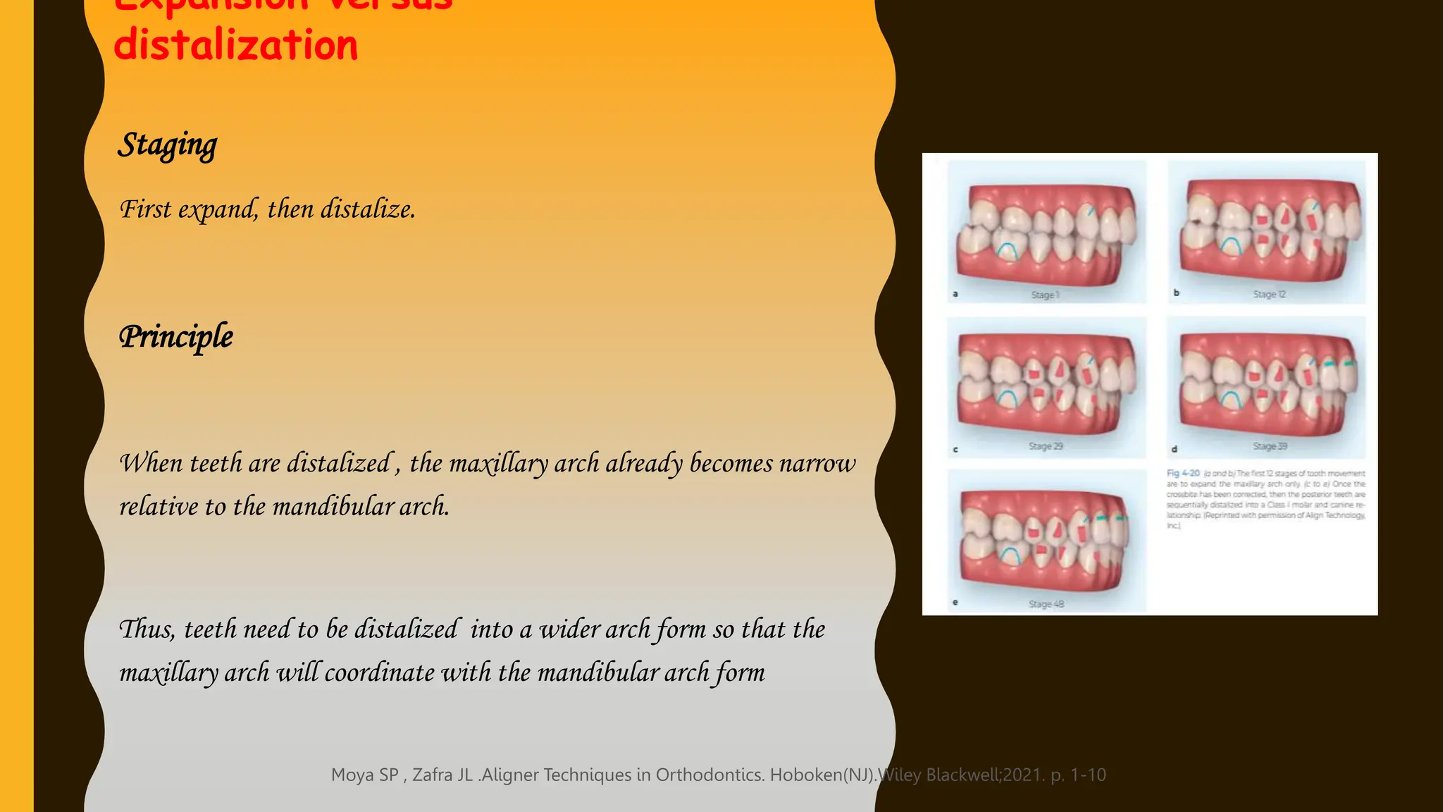 CLEAR ALIGNER THERAPY IN ORTHODONTICS .pptx