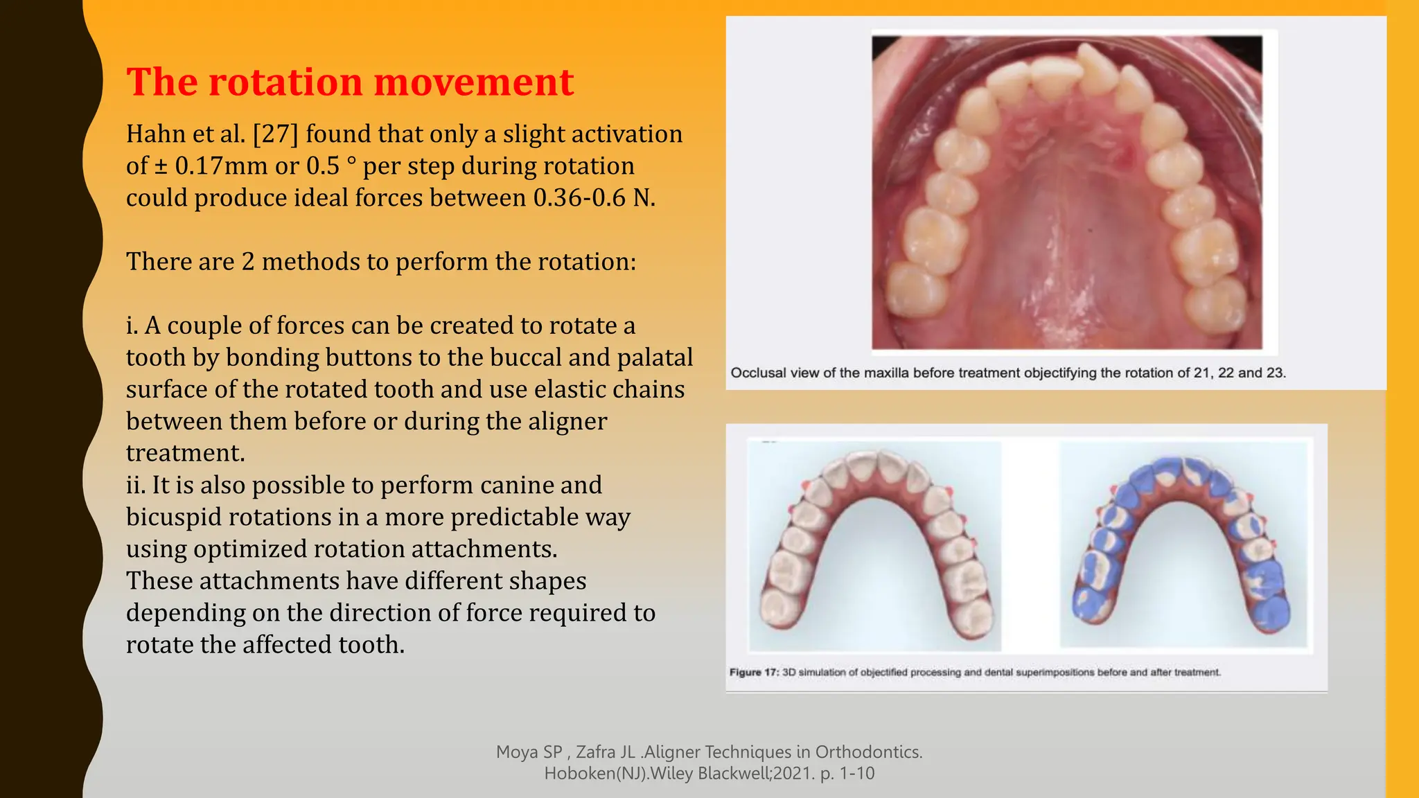 CLEAR ALIGNER THERAPY IN ORTHODONTICS .pptx