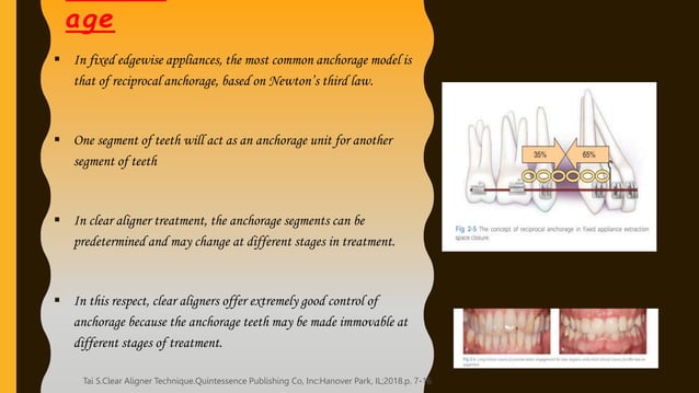 CLEAR ALIGNER THERAPY IN ORTHODONTICS .pptx | Oral care | Personal Care