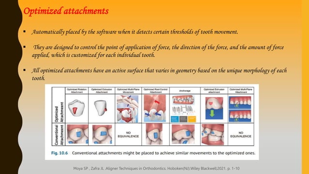 CLEAR ALIGNER THERAPY IN ORTHODONTICS .pptx | Oral care | Personal Care
