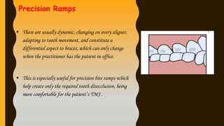 CLEAR ALIGNER THERAPY IN ORTHODONTICS .pptx