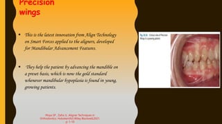CLEAR ALIGNER THERAPY IN ORTHODONTICS .pptx