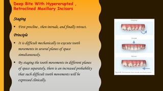 CLEAR ALIGNER THERAPY IN ORTHODONTICS .pptx