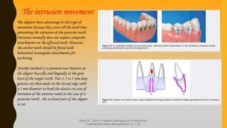 CLEAR ALIGNER THERAPY IN ORTHODONTICS .pptx