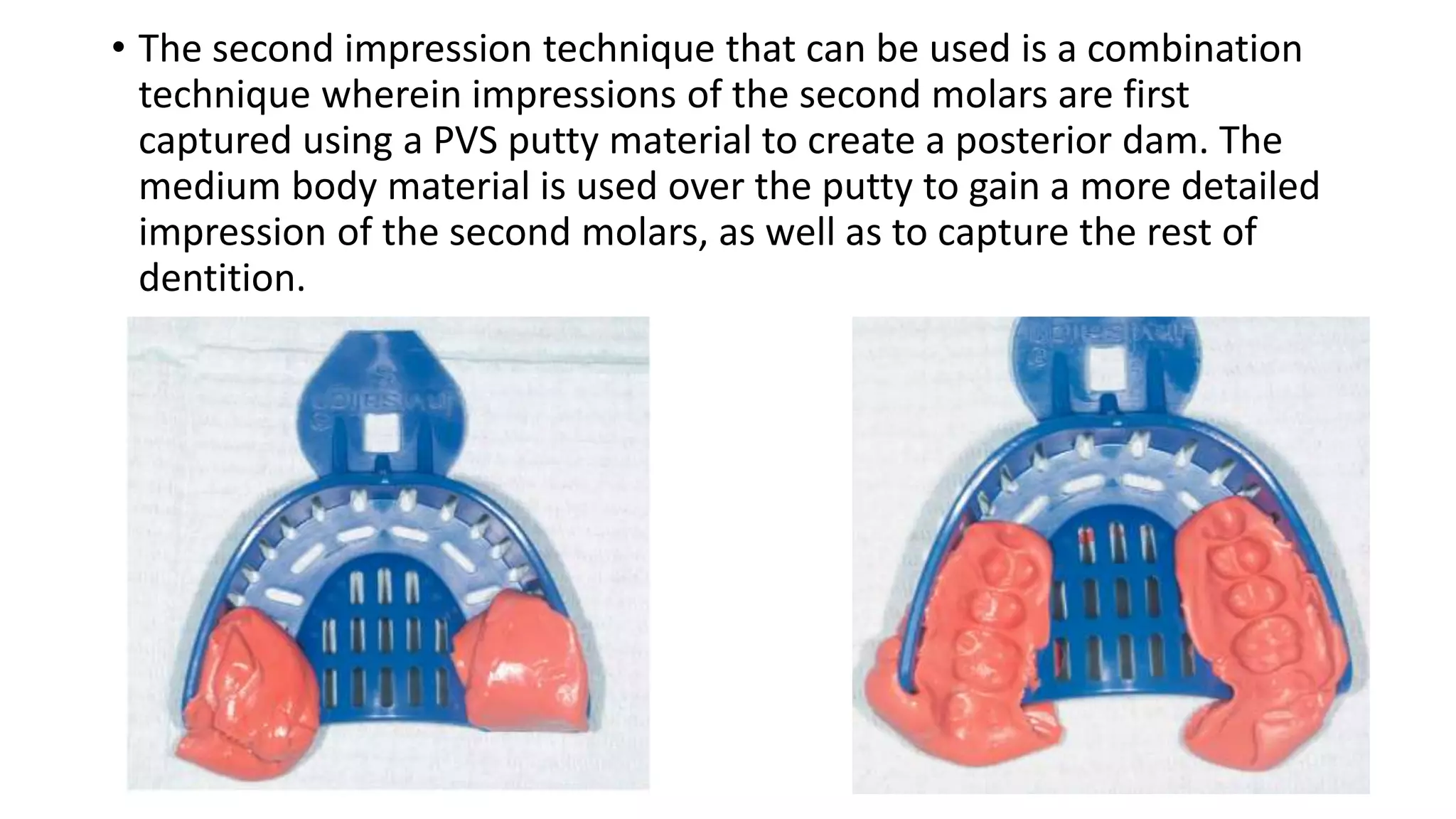 Clear aligner treatment | PPTX