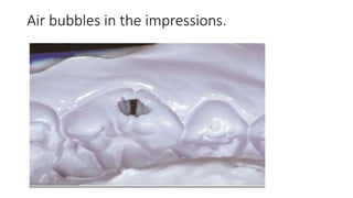 Clear aligner treatment | PPTX