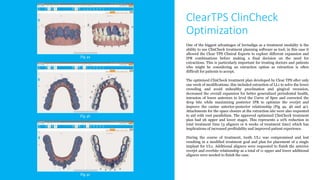 Shorten Invisalign Treatment by 10-20% without Acceleration. Invisalign ...