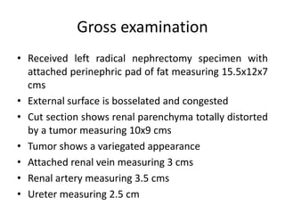 Clear cell variant of renal cell acrcinoma | PPTX