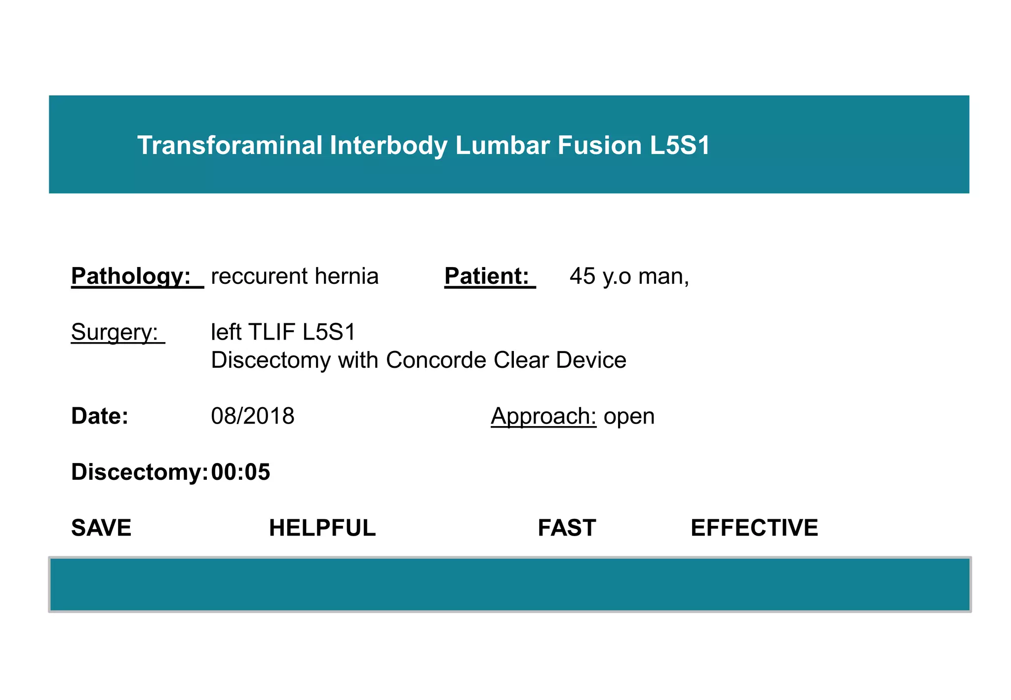Lumbar discectomy device Concorde Clear | PPTX