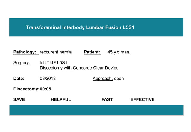 Lumbar discectomy device Concorde Clear | PPTX