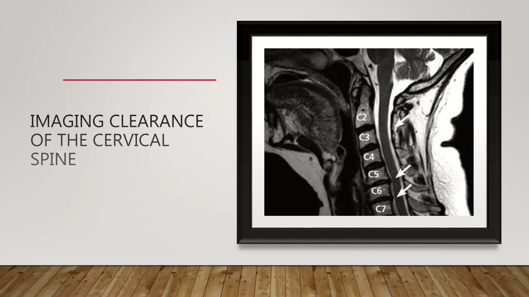 Clearing cervical collar | PPT