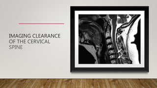 Clearing cervical collar | PPTX