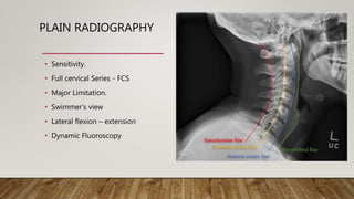 Clearing cervical collar | PPTX