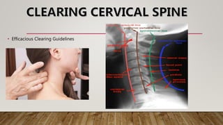 Clearing cervical collar | PPTX