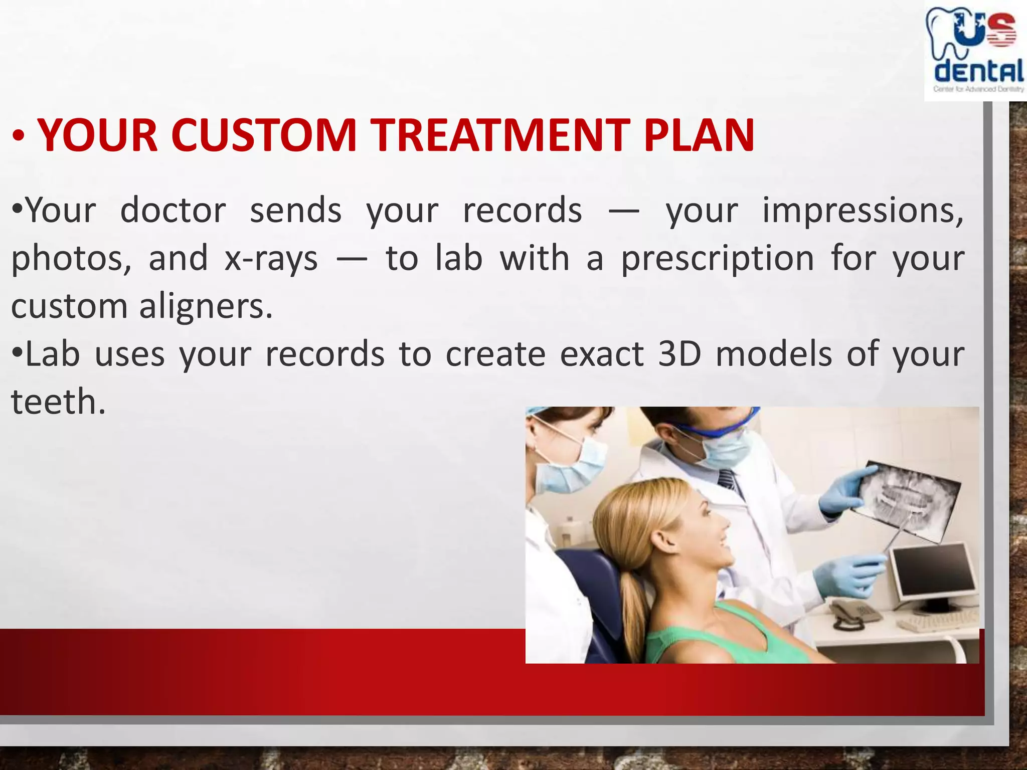 Clear Orthodontic Aligners | PPTX