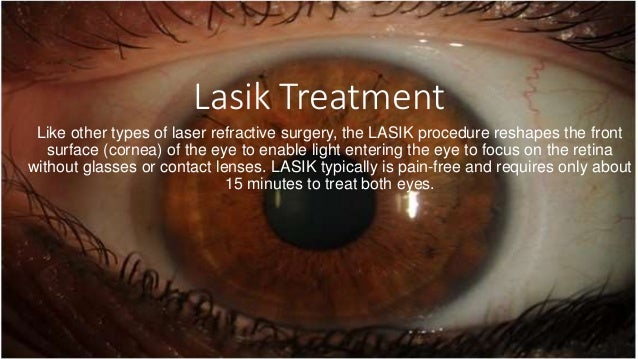 Clear vision lasik ppt 2022 | PPTX