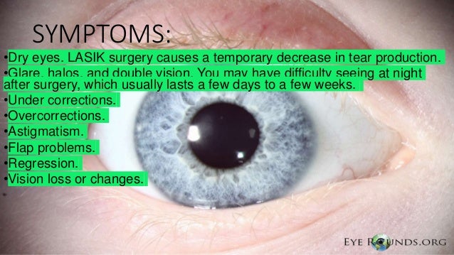 Clear vision lasik ppt 2022 | PPTX