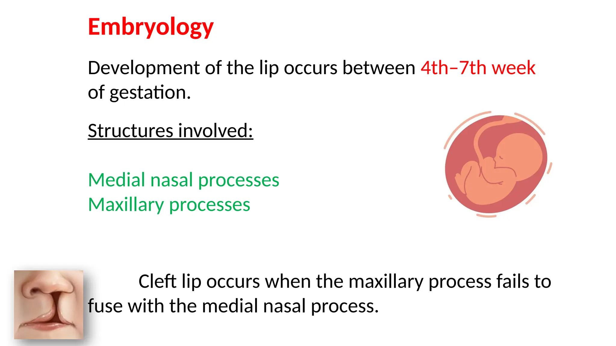 cleft lip.A medical student presentation | PPTX